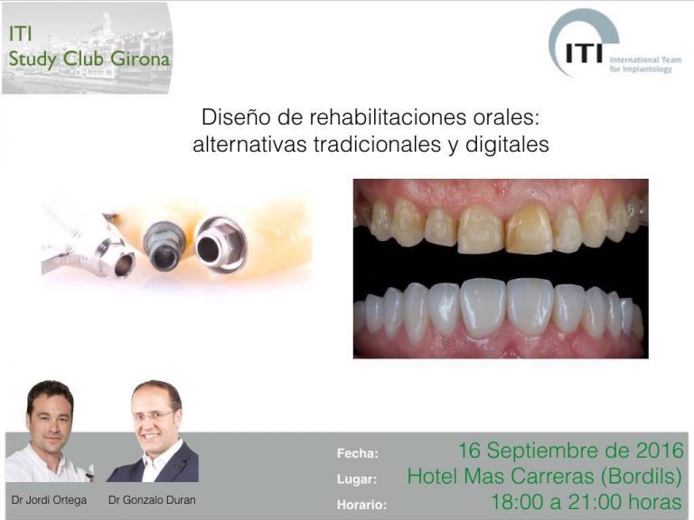 Curso ponente ITI Study Club - CLINICA DENTAL ZONA FRANCA